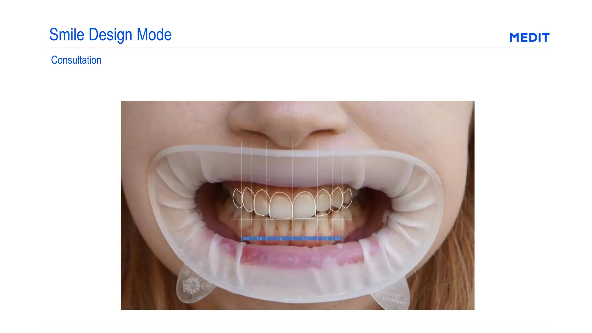 Smile Design in CAD Software User Manual.pptx