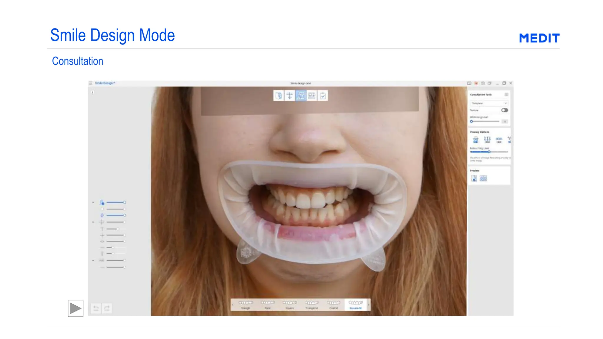 Smile Design in CAD Software User Manual.pptx