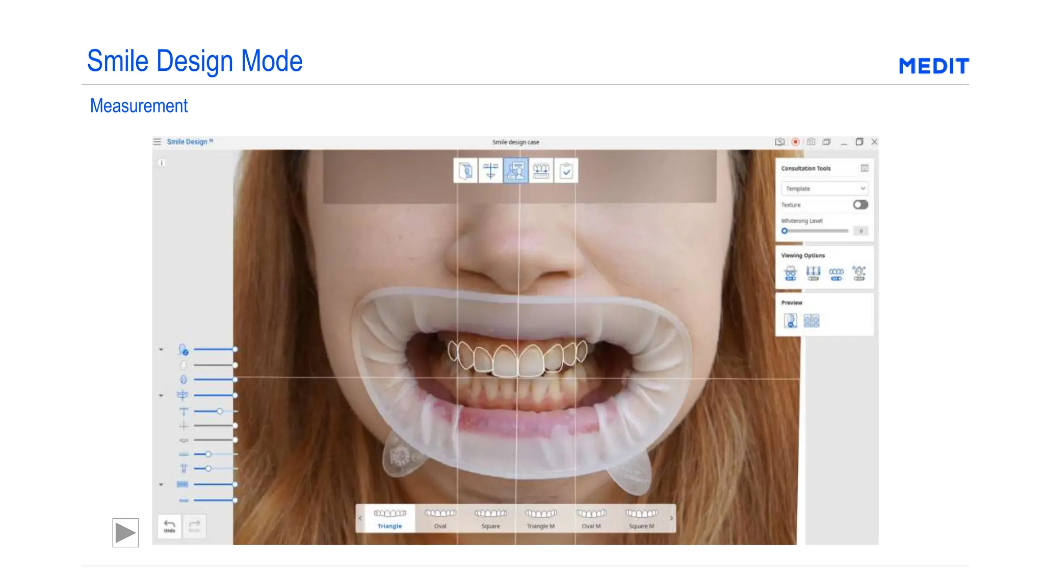Smile Design in CAD Software User Manual.pptx