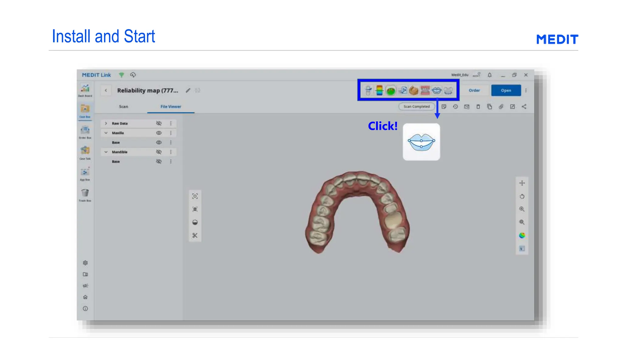Smile Design in CAD Software User Manual.pptx