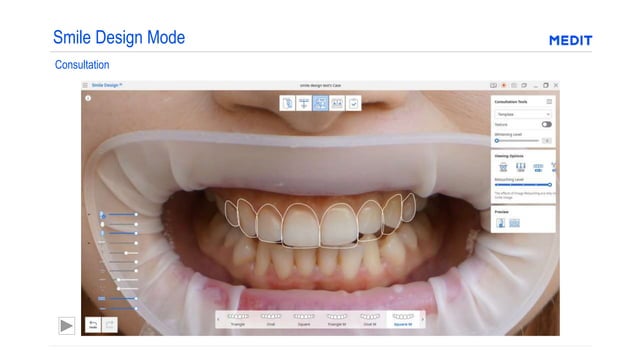 Smile Design in CAD Software User Manual.pptx | Photo Editing Software ...