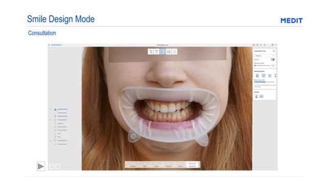 Smile Design in CAD Software User Manual.pptx | Photo Editing Software ...