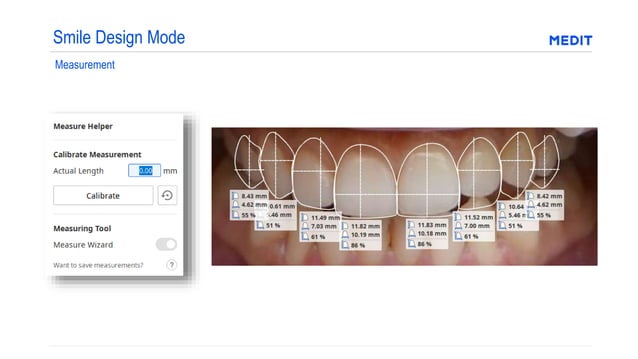 Smile Design in CAD Software User Manual.pptx | Photo Editing Software ...