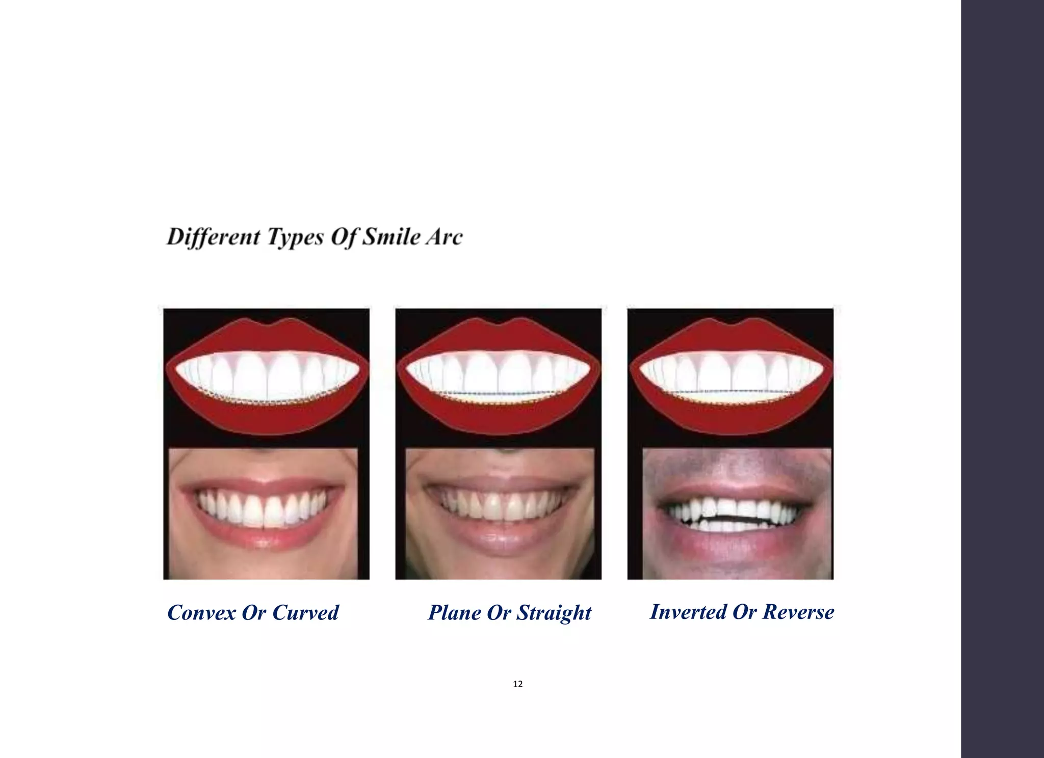 Smile esthetics in orthodontics | PPTX