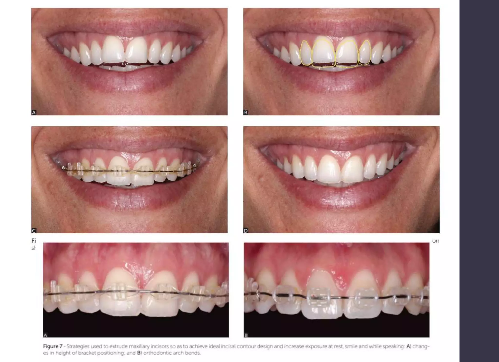 Smile esthetics in orthodontics | PPTX