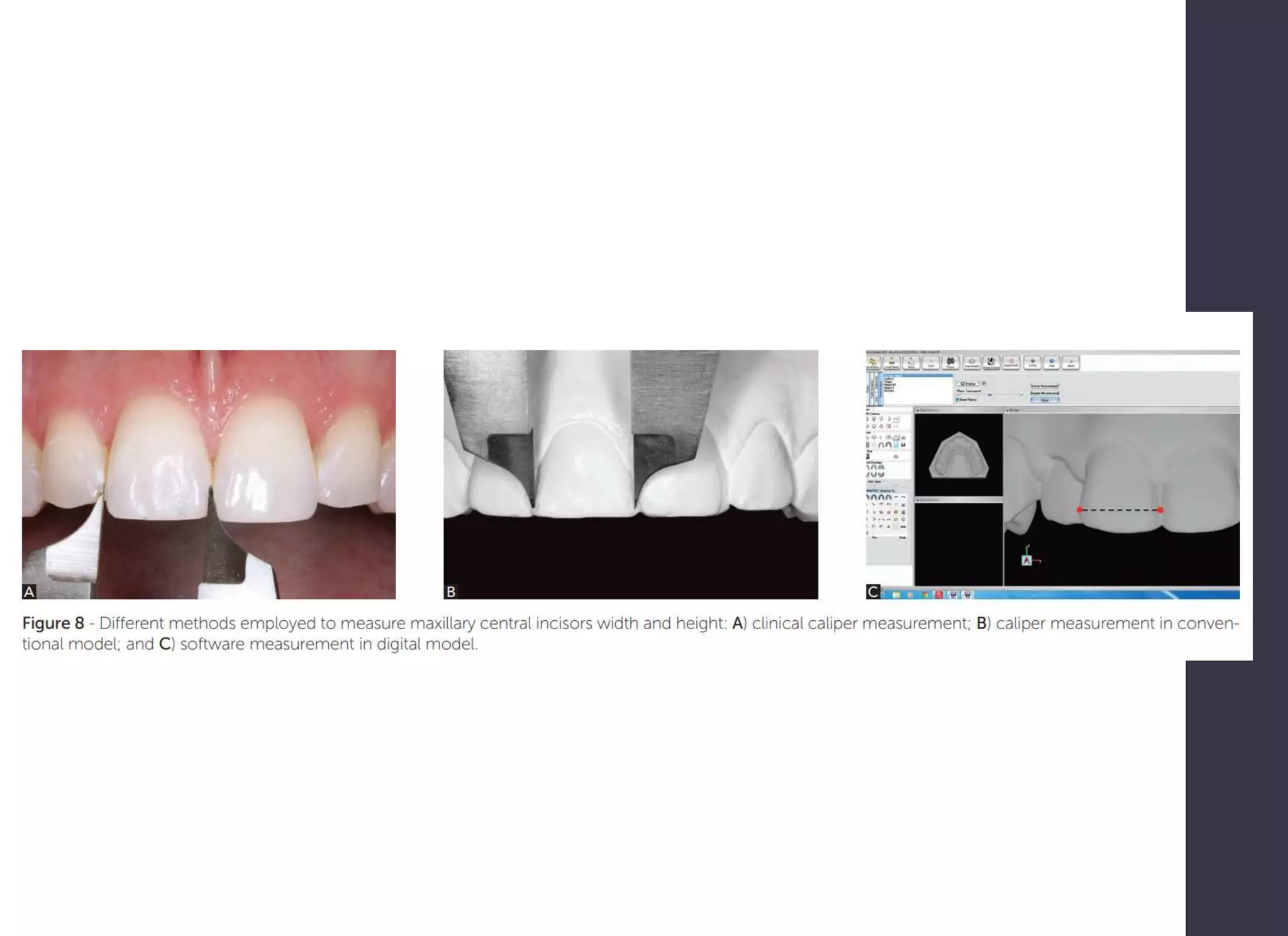 Smile esthetics in orthodontics | PPTX