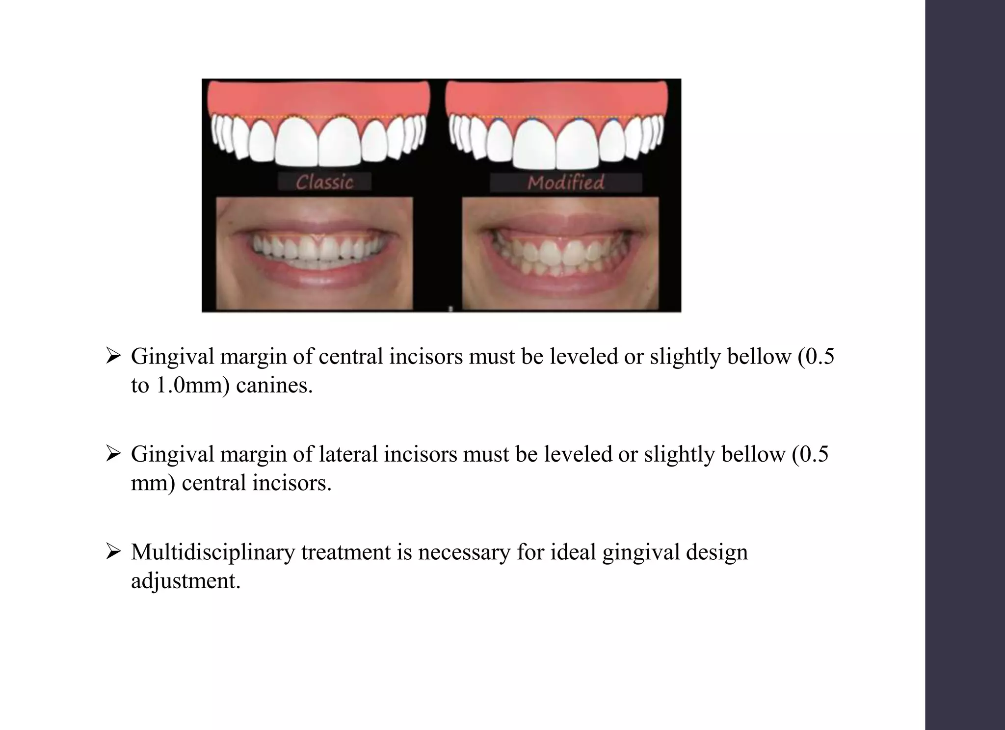 Smile esthetics in orthodontics | PPTX
