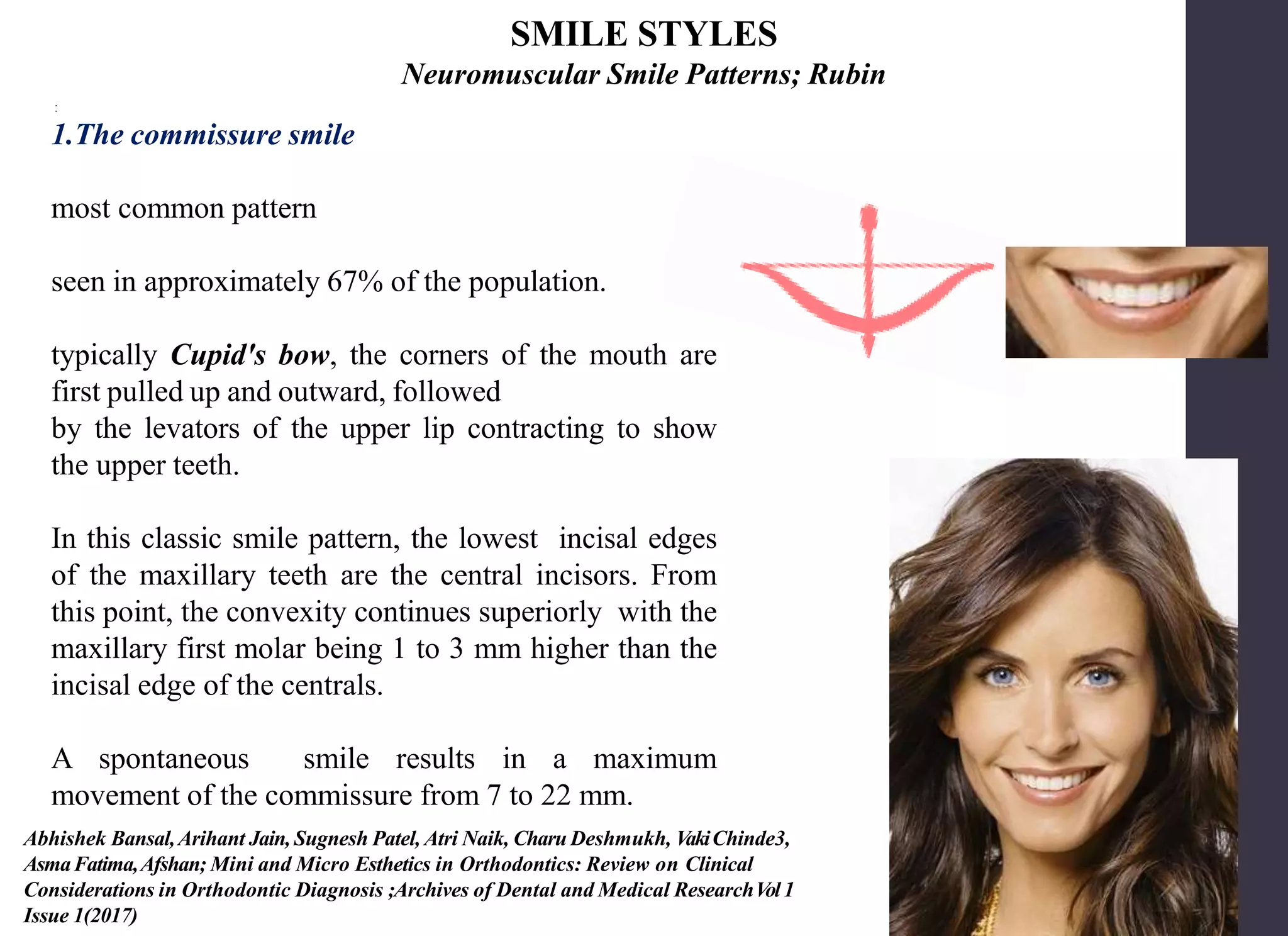 Smile esthetics in orthodontics | PPTX