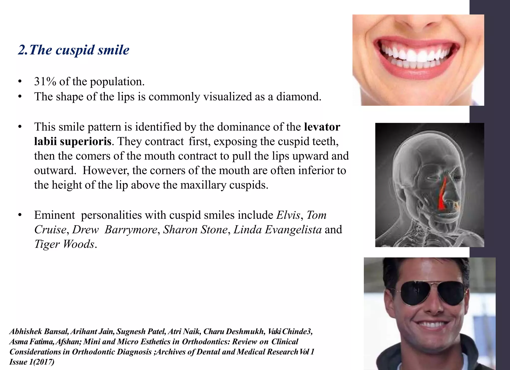 Smile esthetics in orthodontics | PPTX