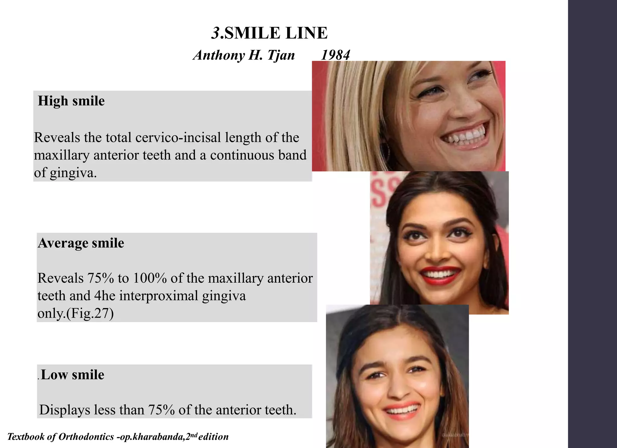 Smile esthetics in orthodontics | PPTX