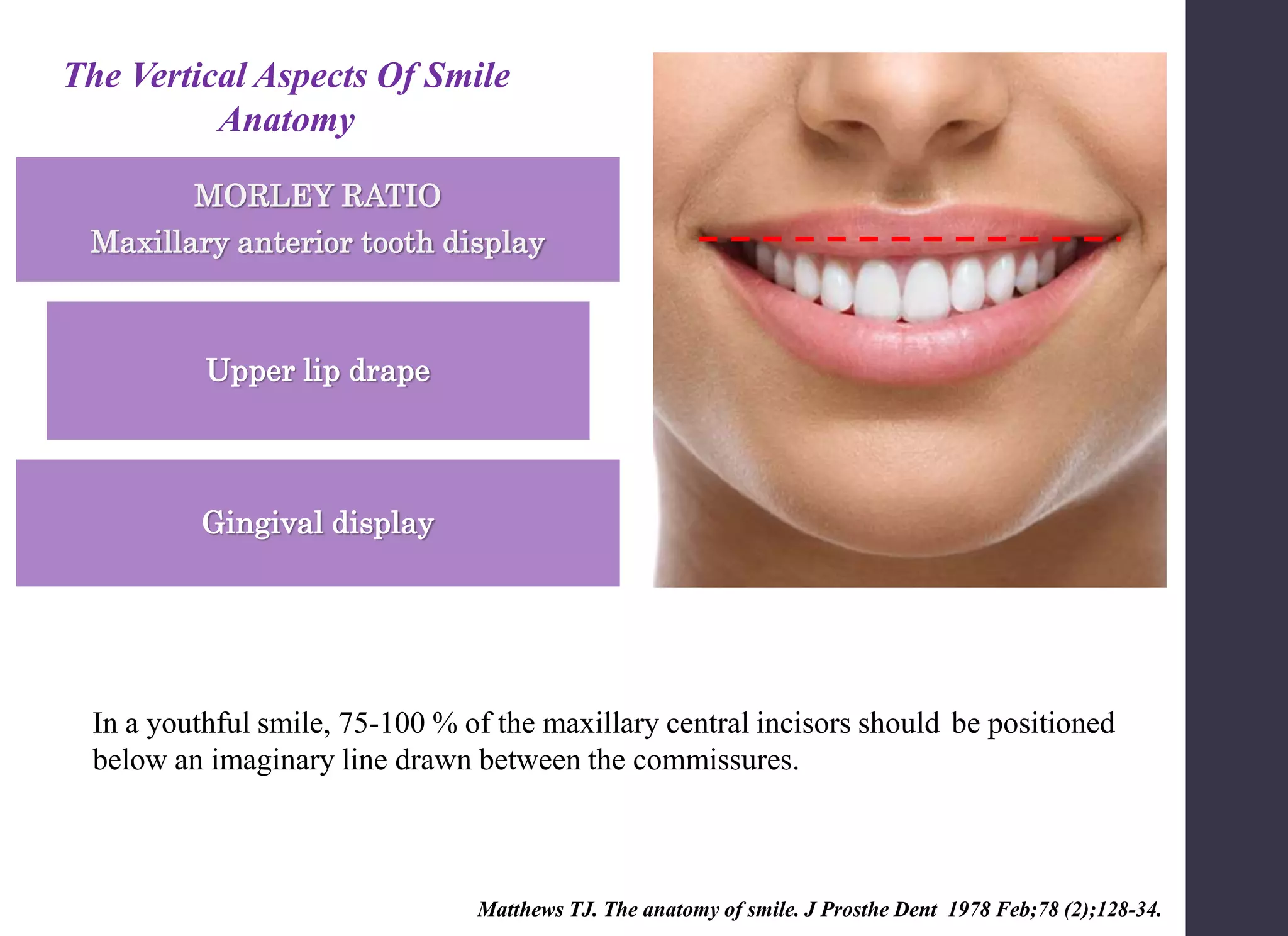 Smile esthetics in orthodontics | PPTX