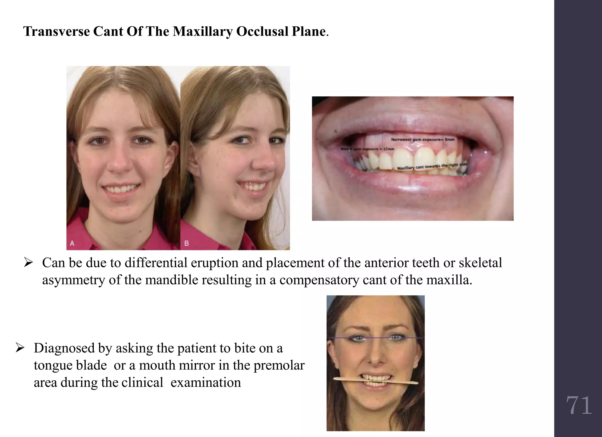 Smile esthetics in orthodontics | PPTX