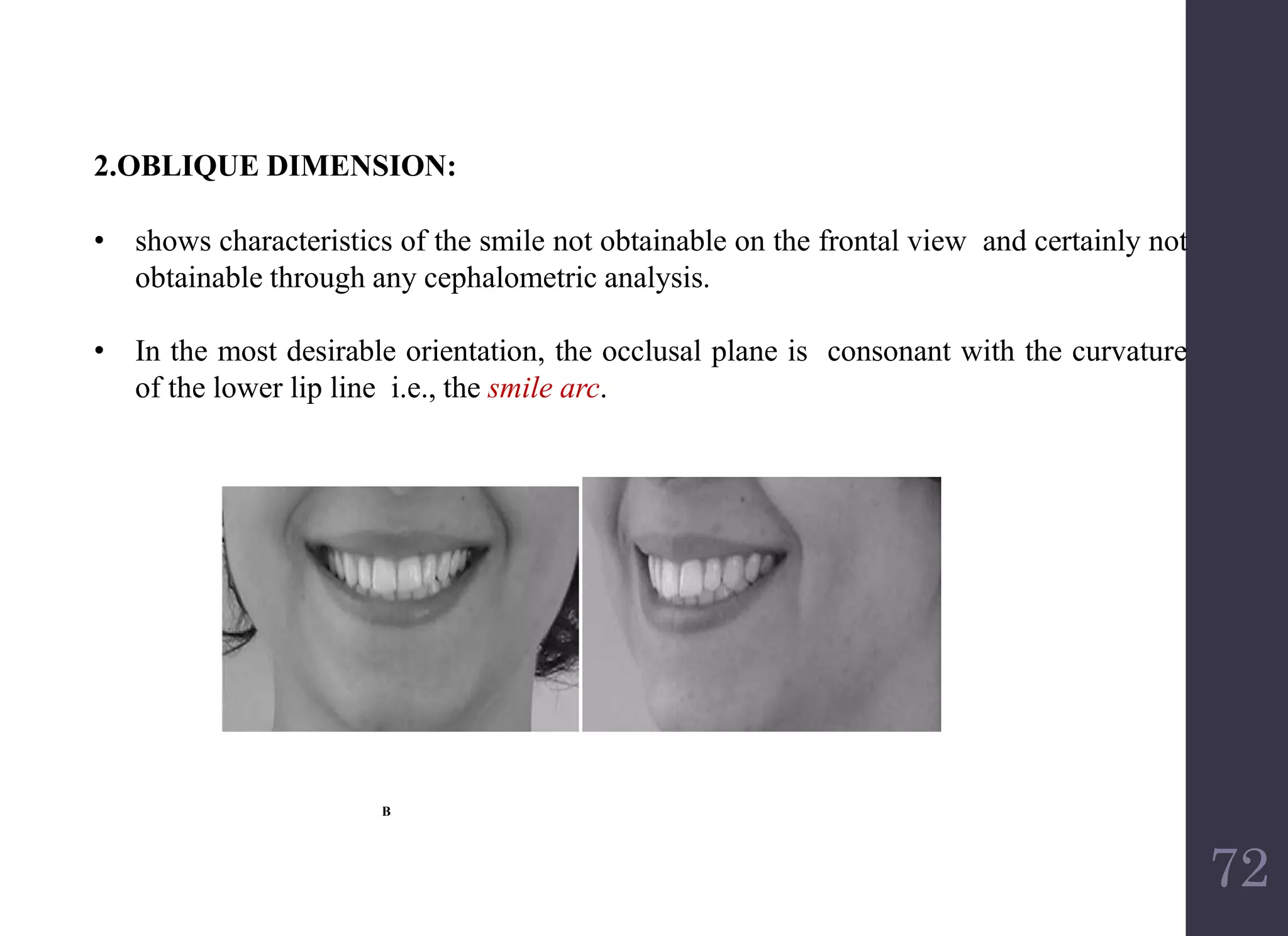 Smile esthetics in orthodontics | PPTX