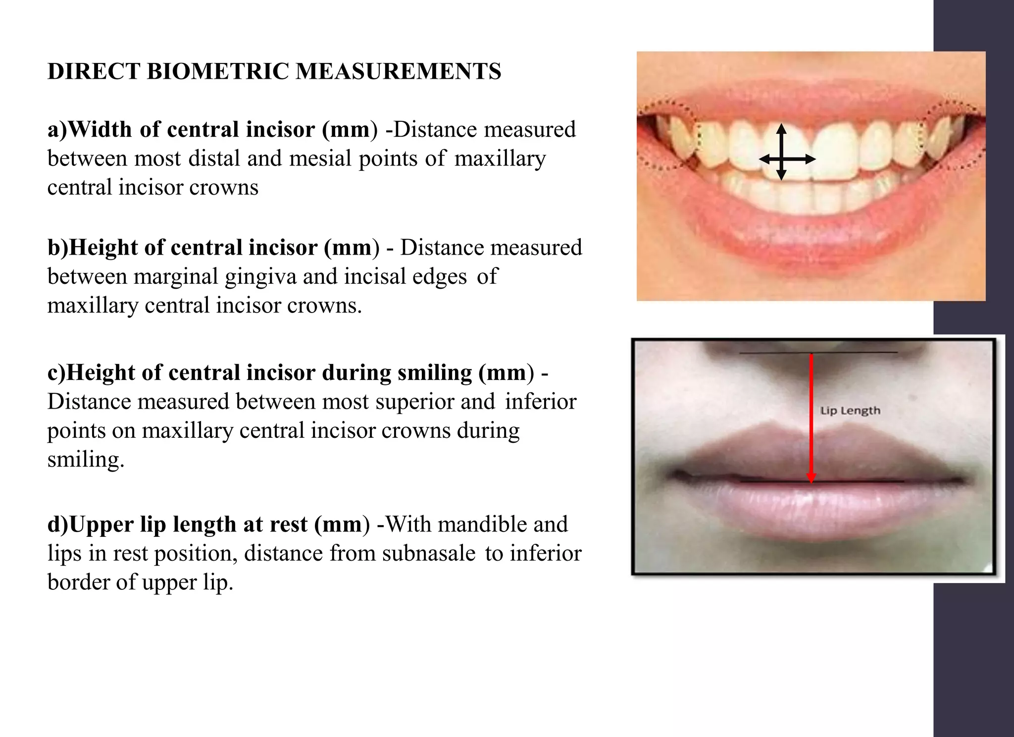 Smile esthetics in orthodontics | PPTX