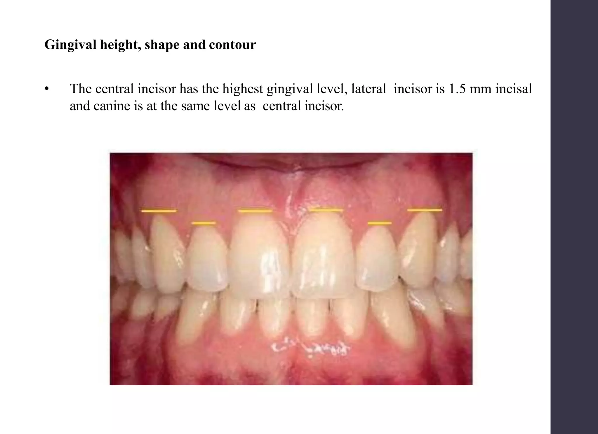 Smile esthetics in orthodontics | PPTX