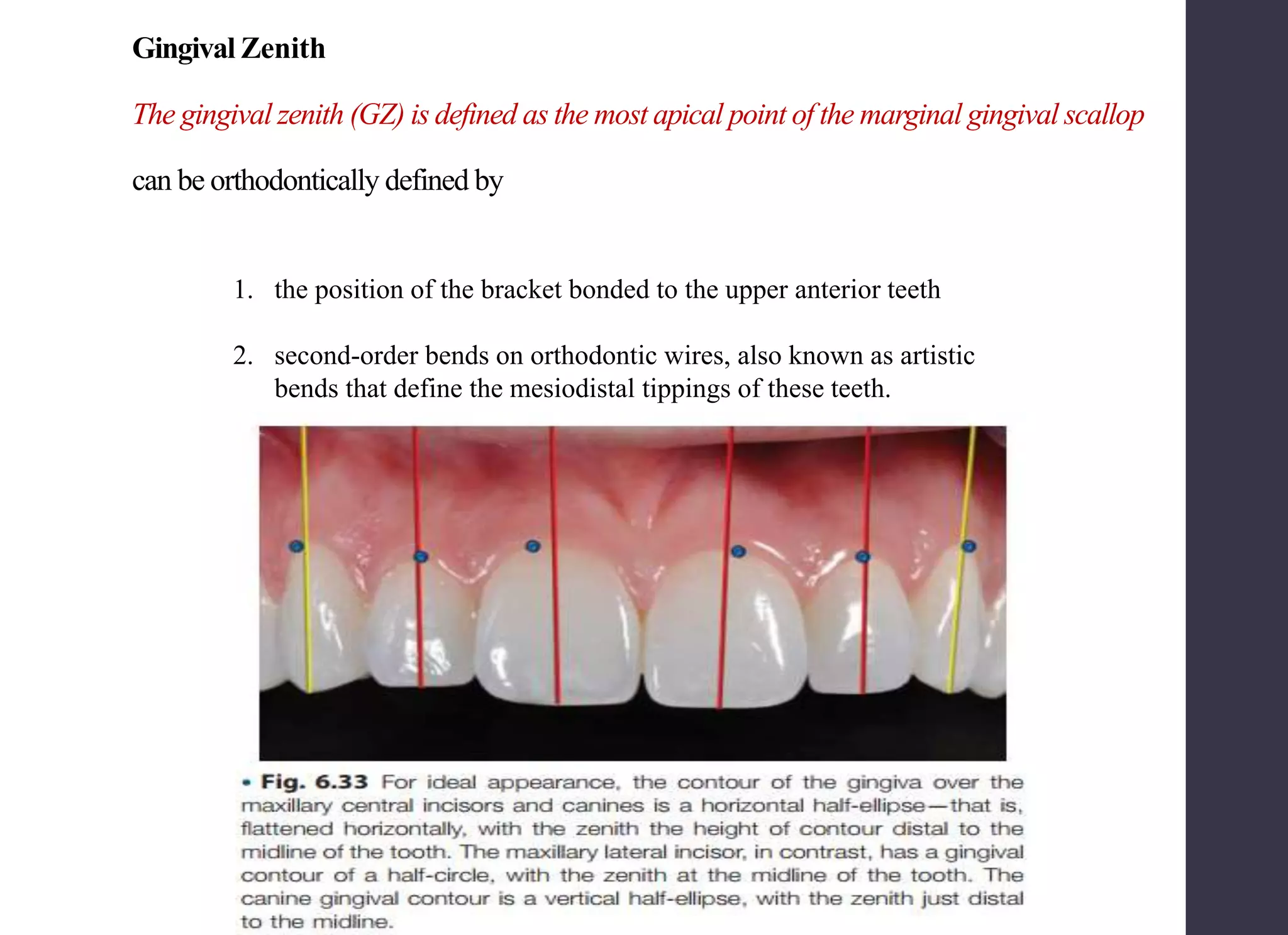 Smile esthetics in orthodontics | PPTX
