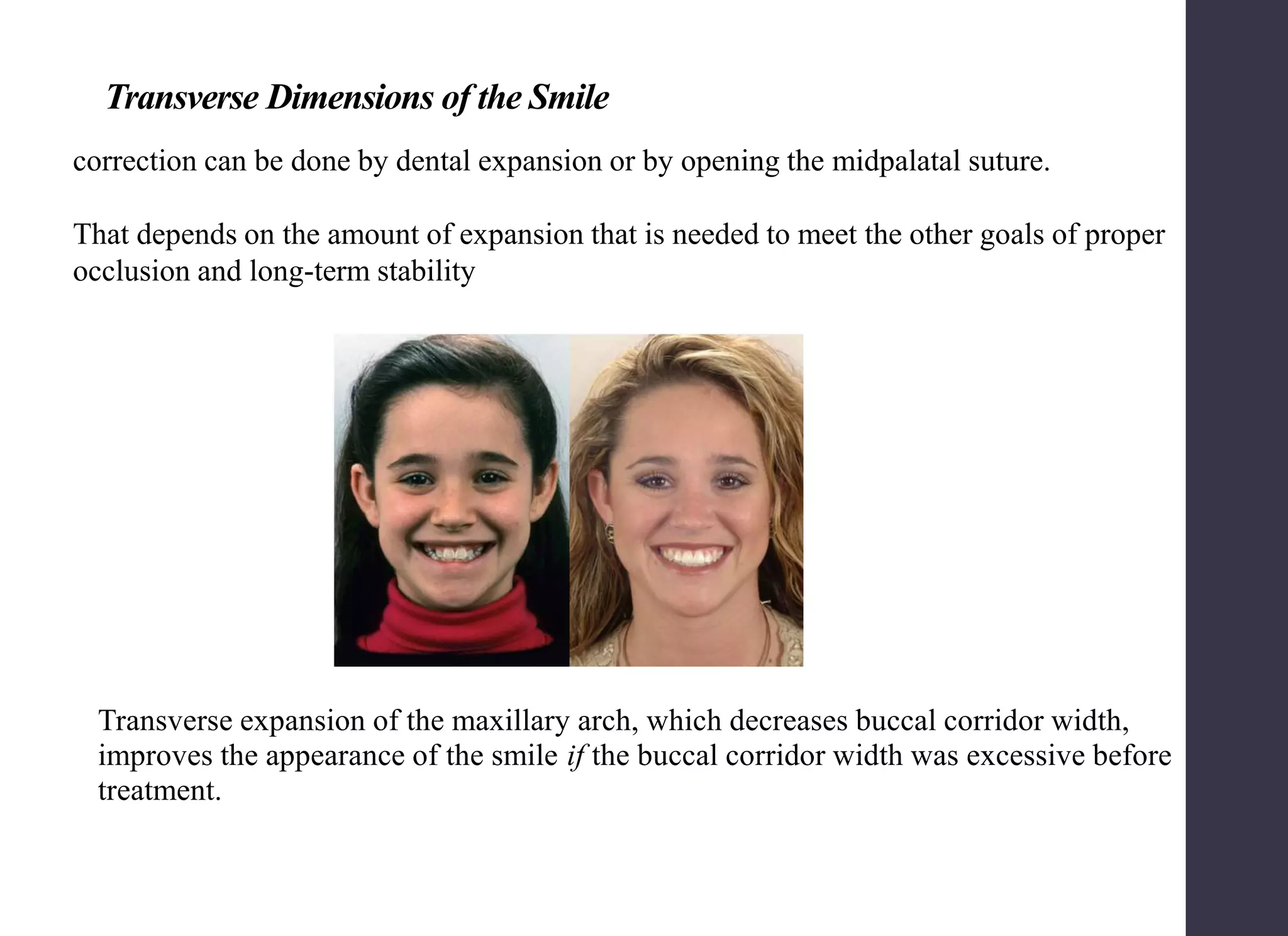 Smile esthetics in orthodontics | PPTX