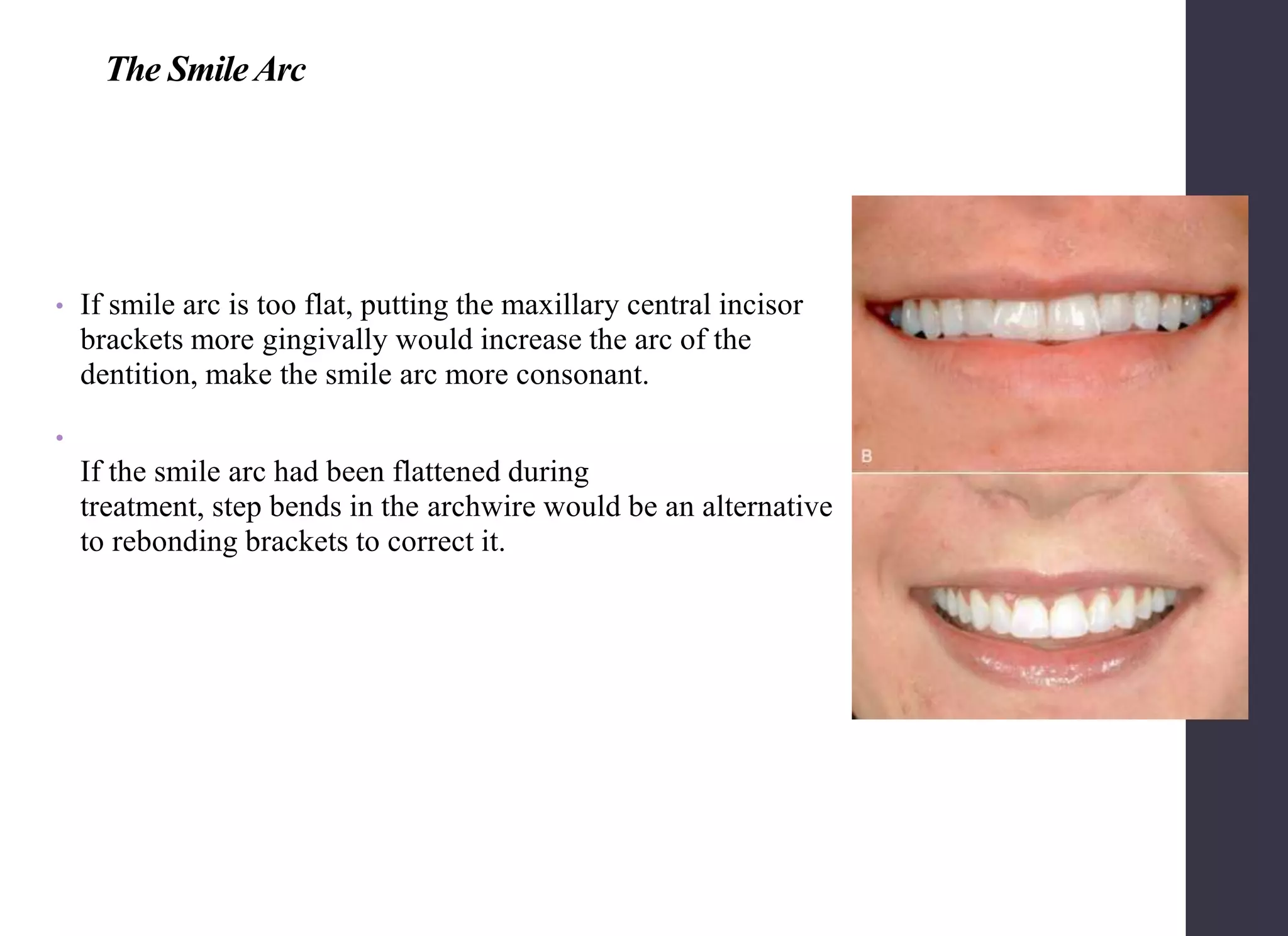 Smile esthetics in orthodontics | PPTX