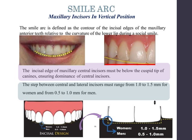Smile esthetics in orthodontics | PPT