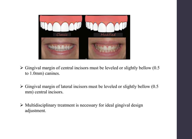 Smile esthetics in orthodontics | PPTX | Dental Health | Diseases and ...