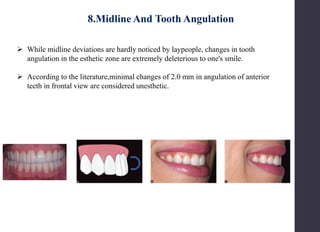 Smile esthetics in orthodontics | PPTX