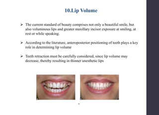 Smile esthetics in orthodontics | PPTX