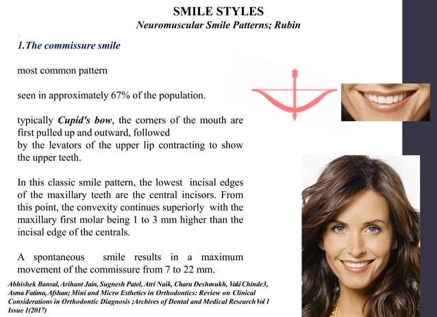 Smile esthetics in orthodontics | PPT