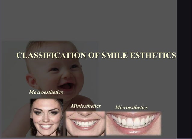 Smile esthetics in orthodontics | PPTX | Dental Health | Diseases and ...