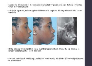Smile esthetics in orthodontics | PPTX | Dental Health | Diseases and ...