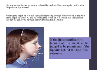 Smile esthetics in orthodontics | PPTX