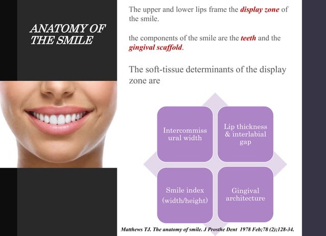 Smile esthetics in orthodontics | PPTX | Dental Health | Diseases and ...