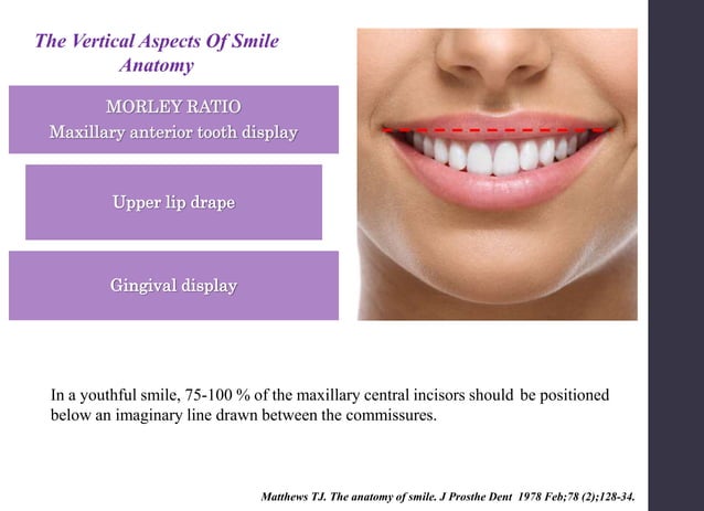 Smile esthetics in orthodontics | PPTX | Dental Health | Diseases and ...