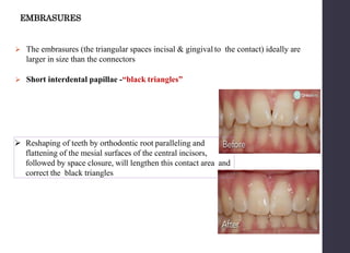 Smile esthetics in orthodontics | PPTX