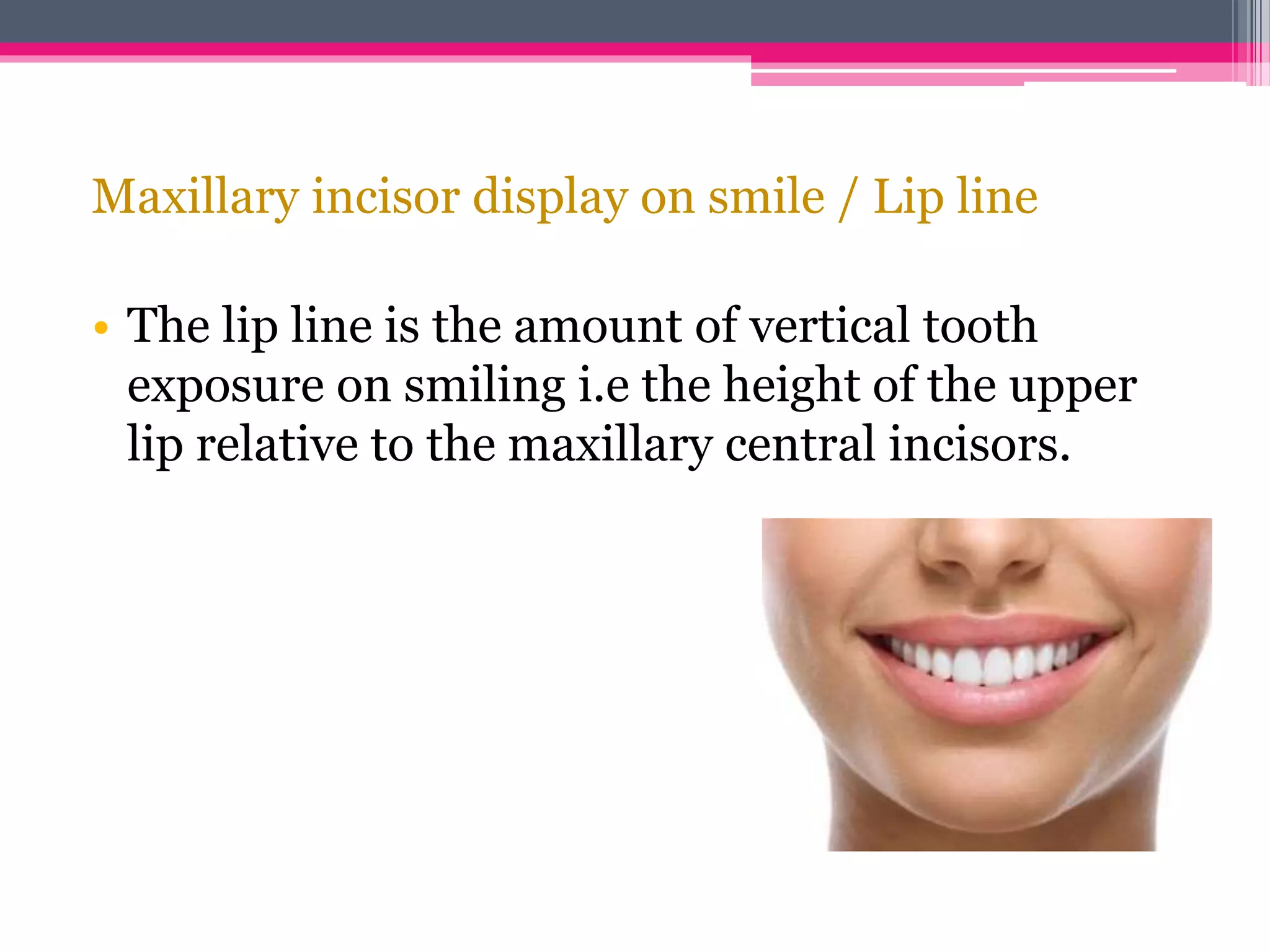 Smile in orthodontics | PPTX