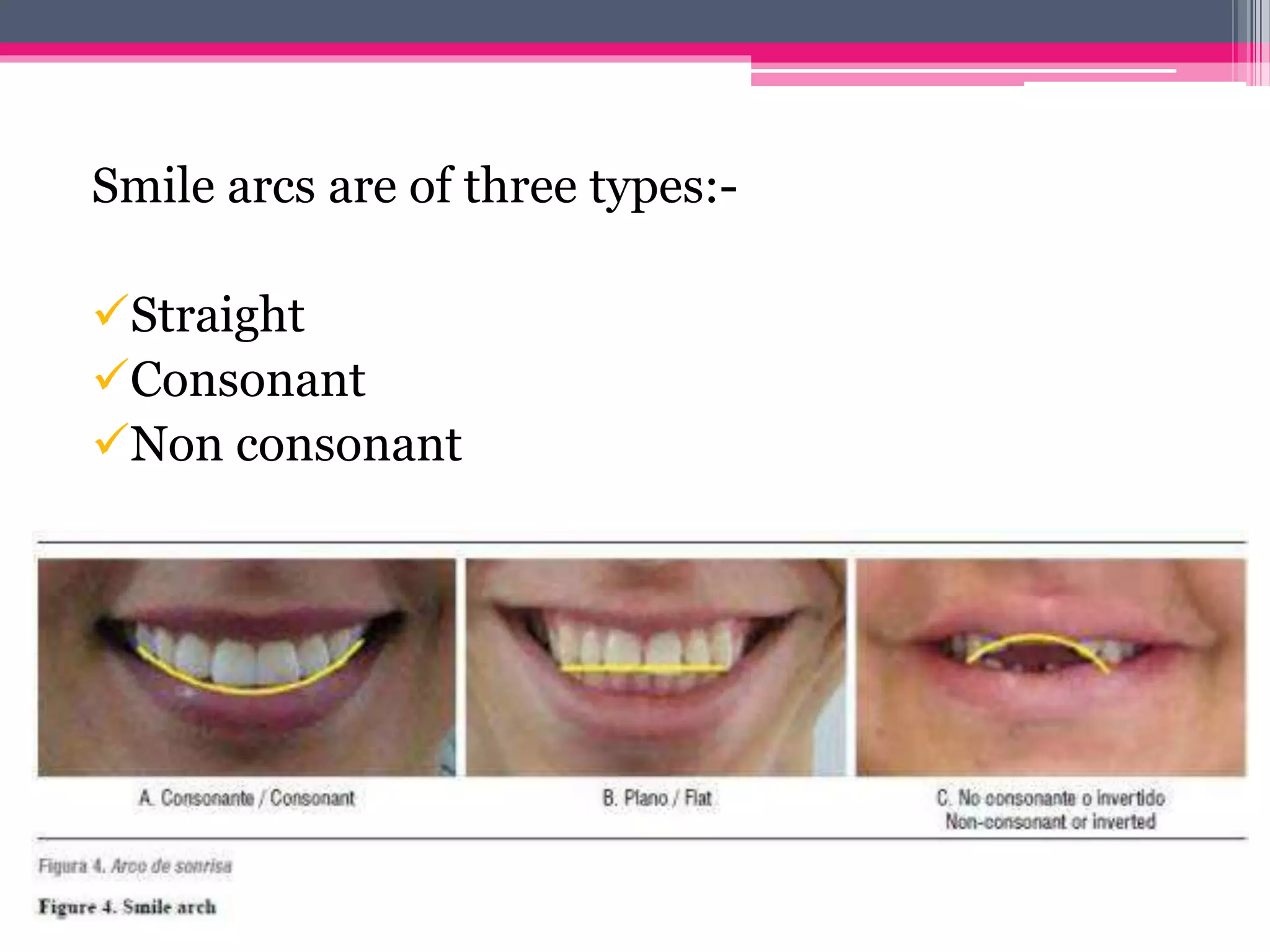 Smile in orthodontics | PPTX