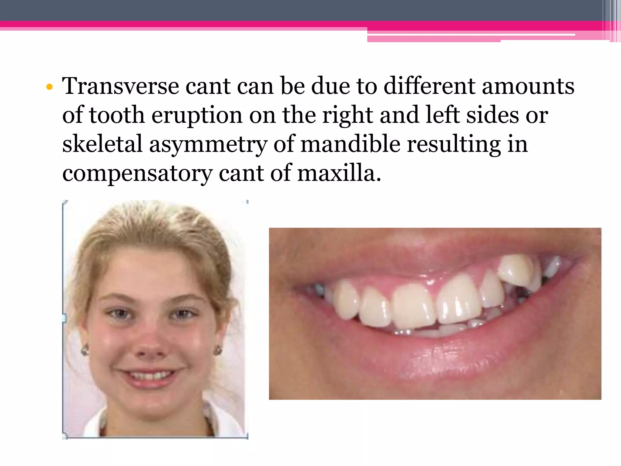 Smile in orthodontics | PPTX