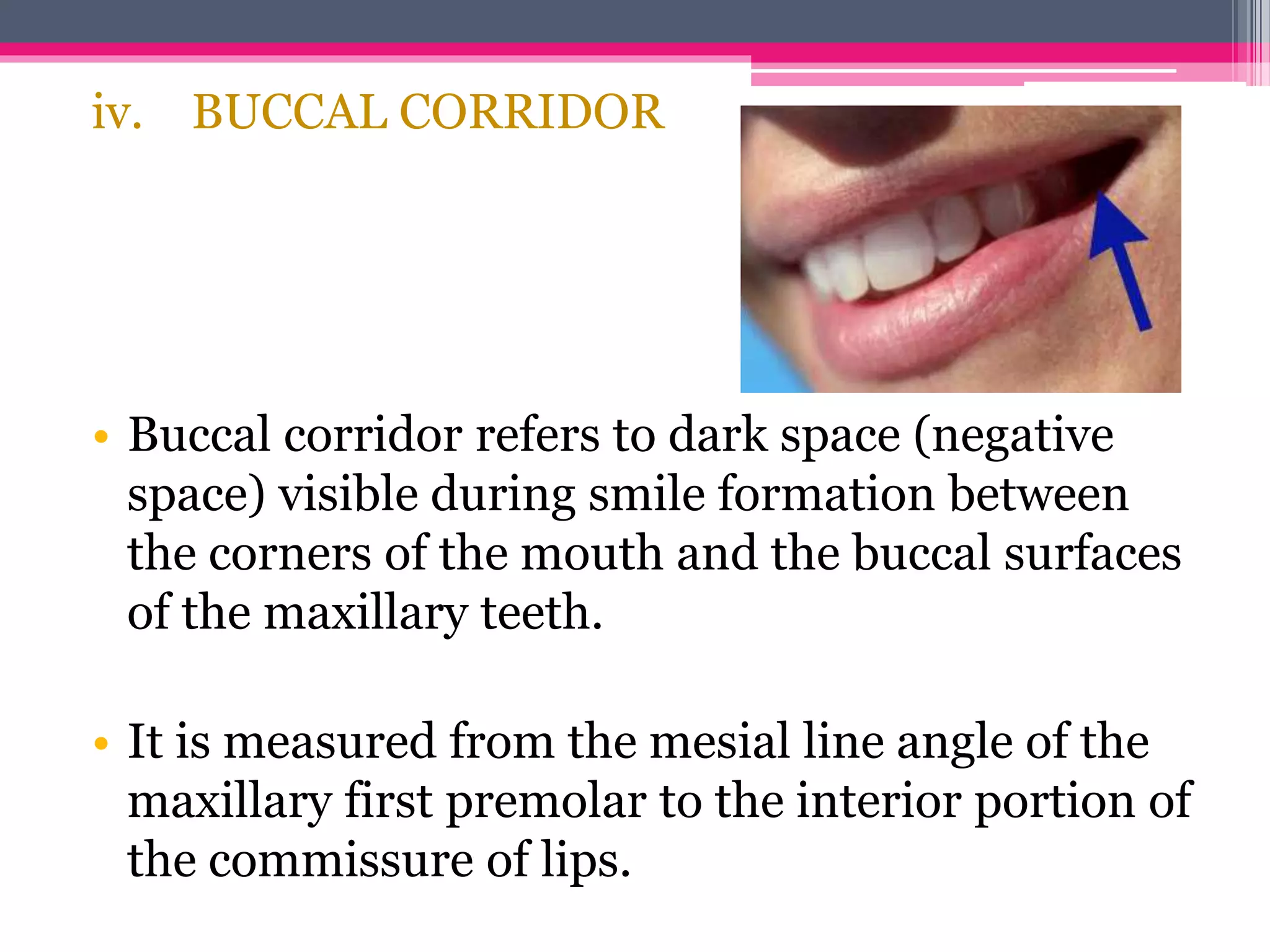 Smile in orthodontics | PPTX