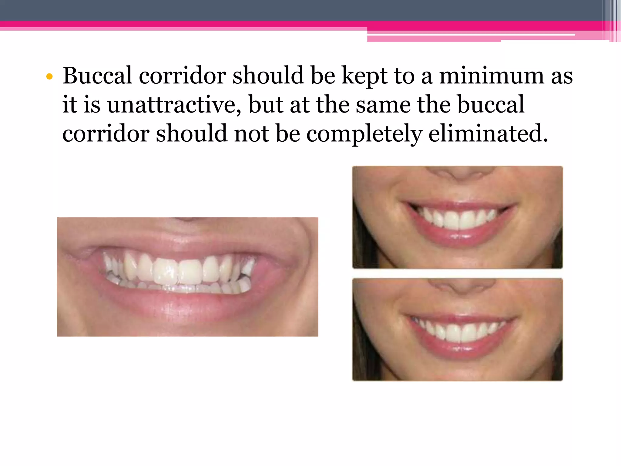 Smile in orthodontics | PPTX