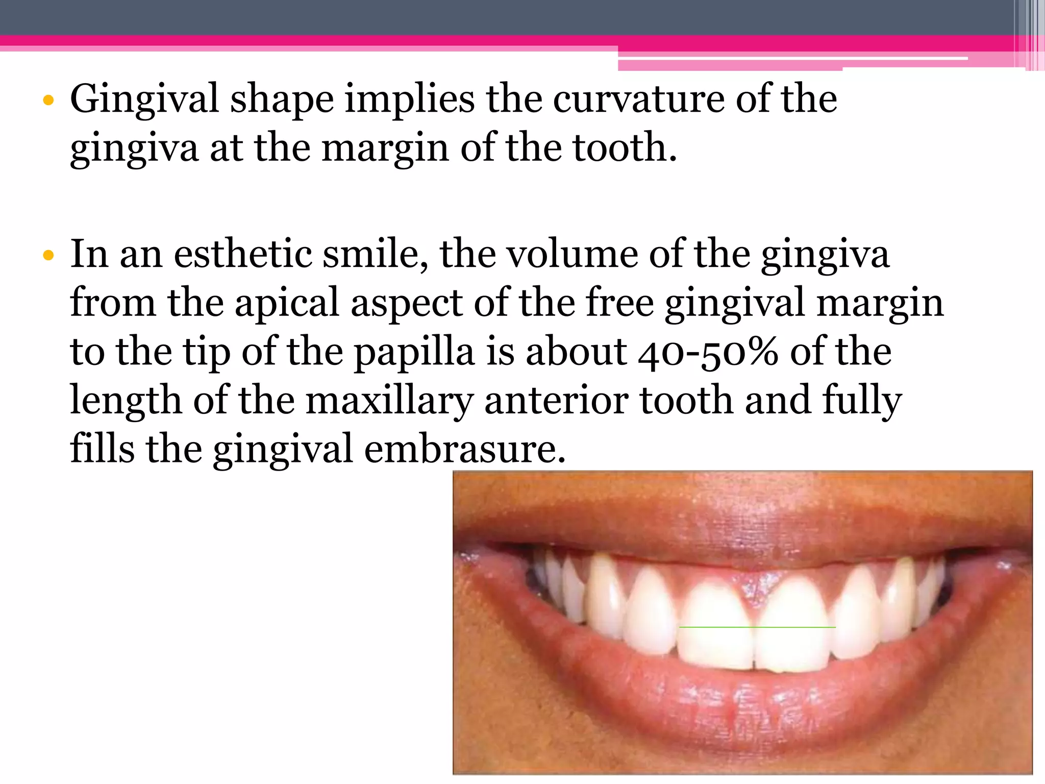 Smile in orthodontics | PPTX