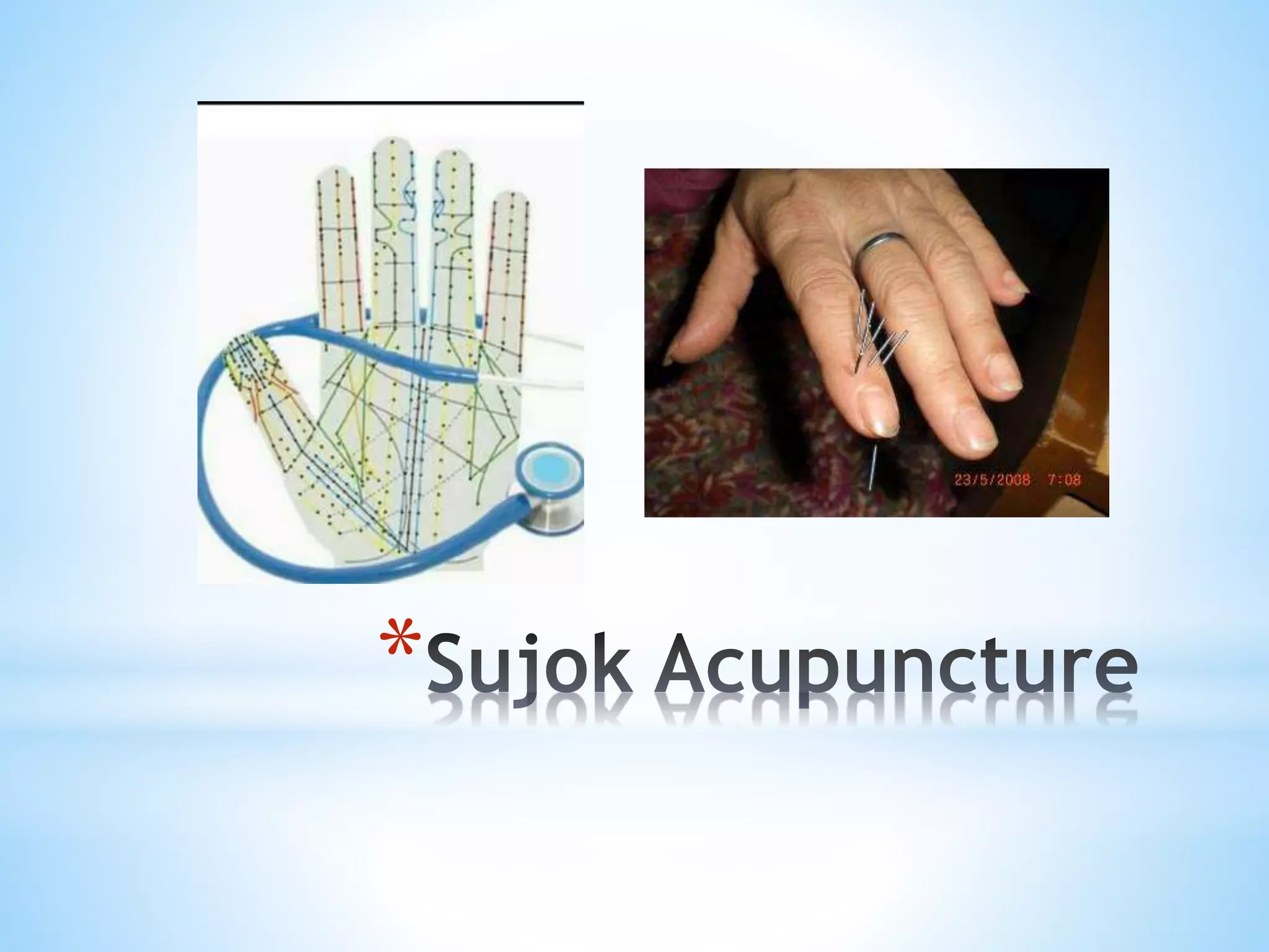 Sujok The Ultimate Healing Tool 2 | PPTX