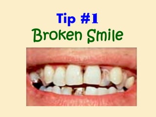 9 Incredible Differerent Smile Transformations | PDF