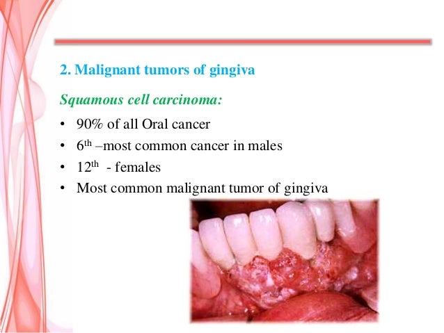 Gingival enlargement