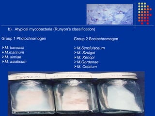 mdr tb and xdr tb | PPT