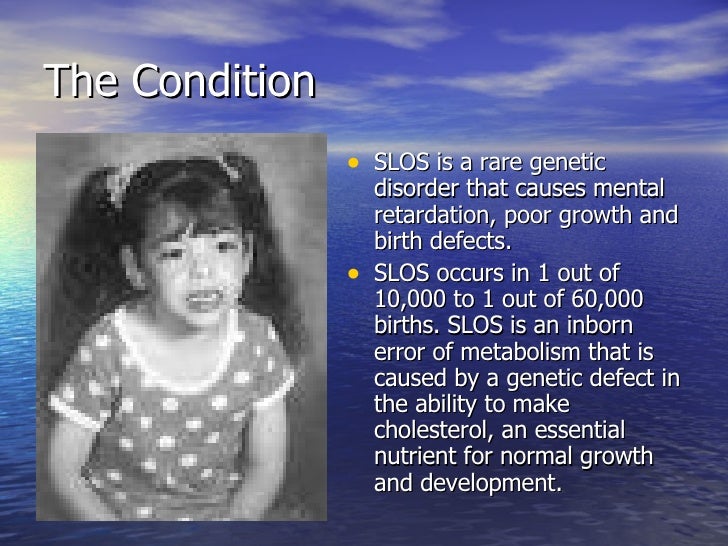 Smith Lemli Opitz Syndrome