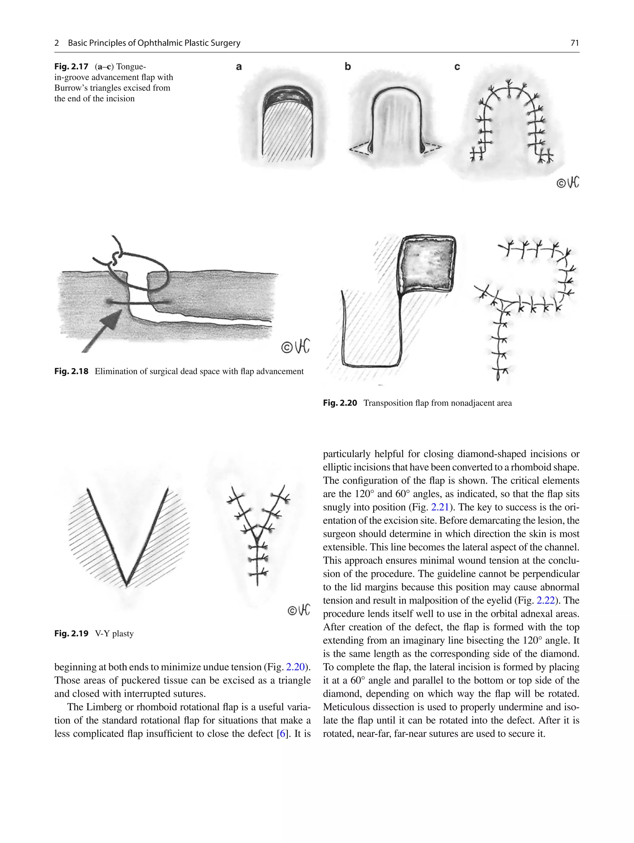 Smith and nesis ophthalmic plastic and reconstructive surgery | PDF