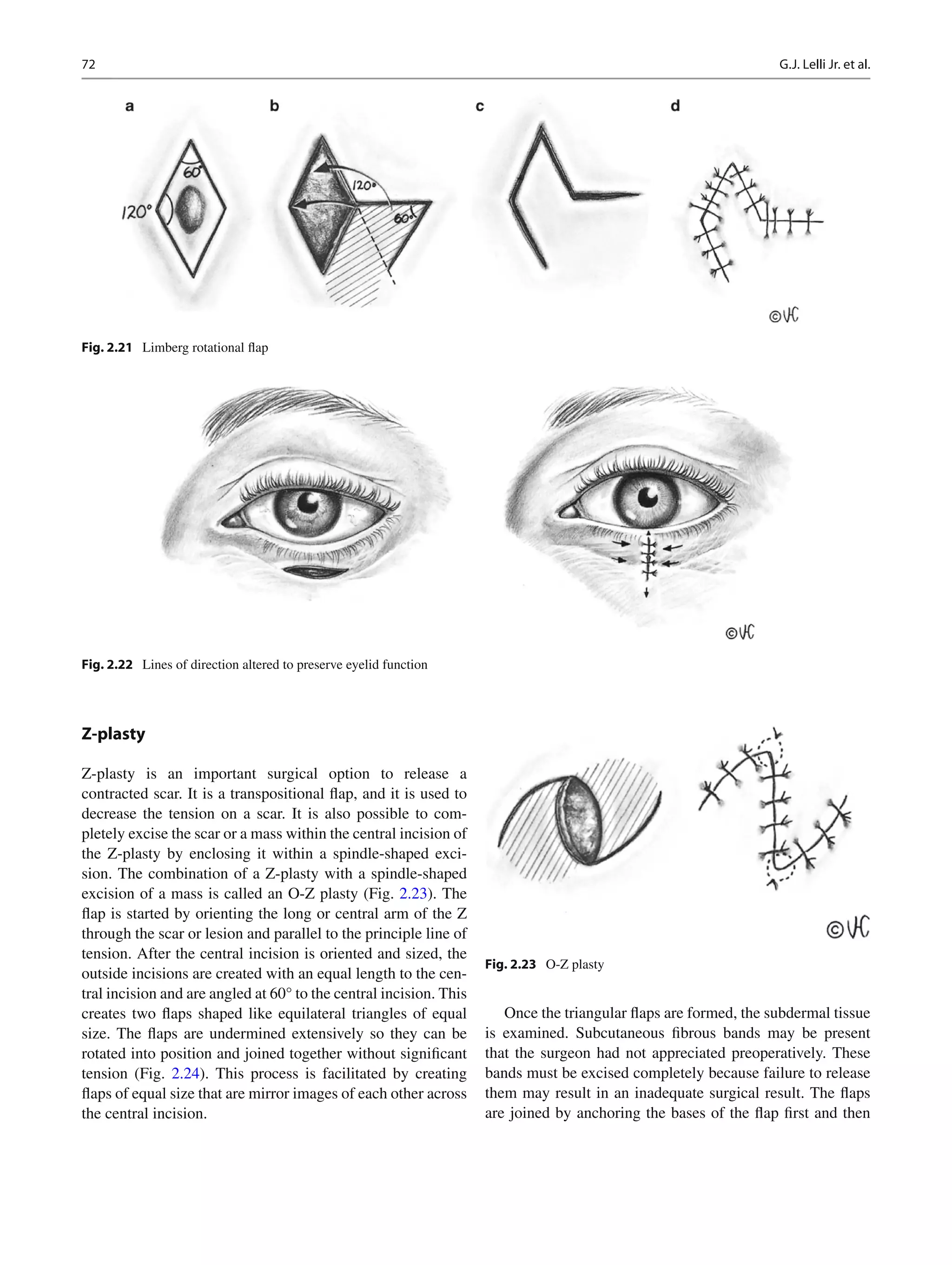 Smith and nesis ophthalmic plastic and reconstructive surgery | PDF