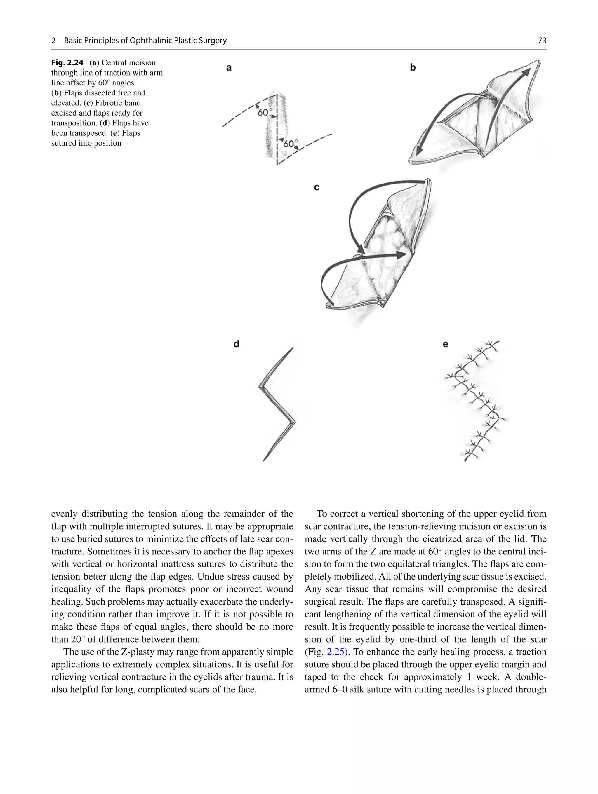 Smith and nesis ophthalmic plastic and reconstructive surgery | PDF