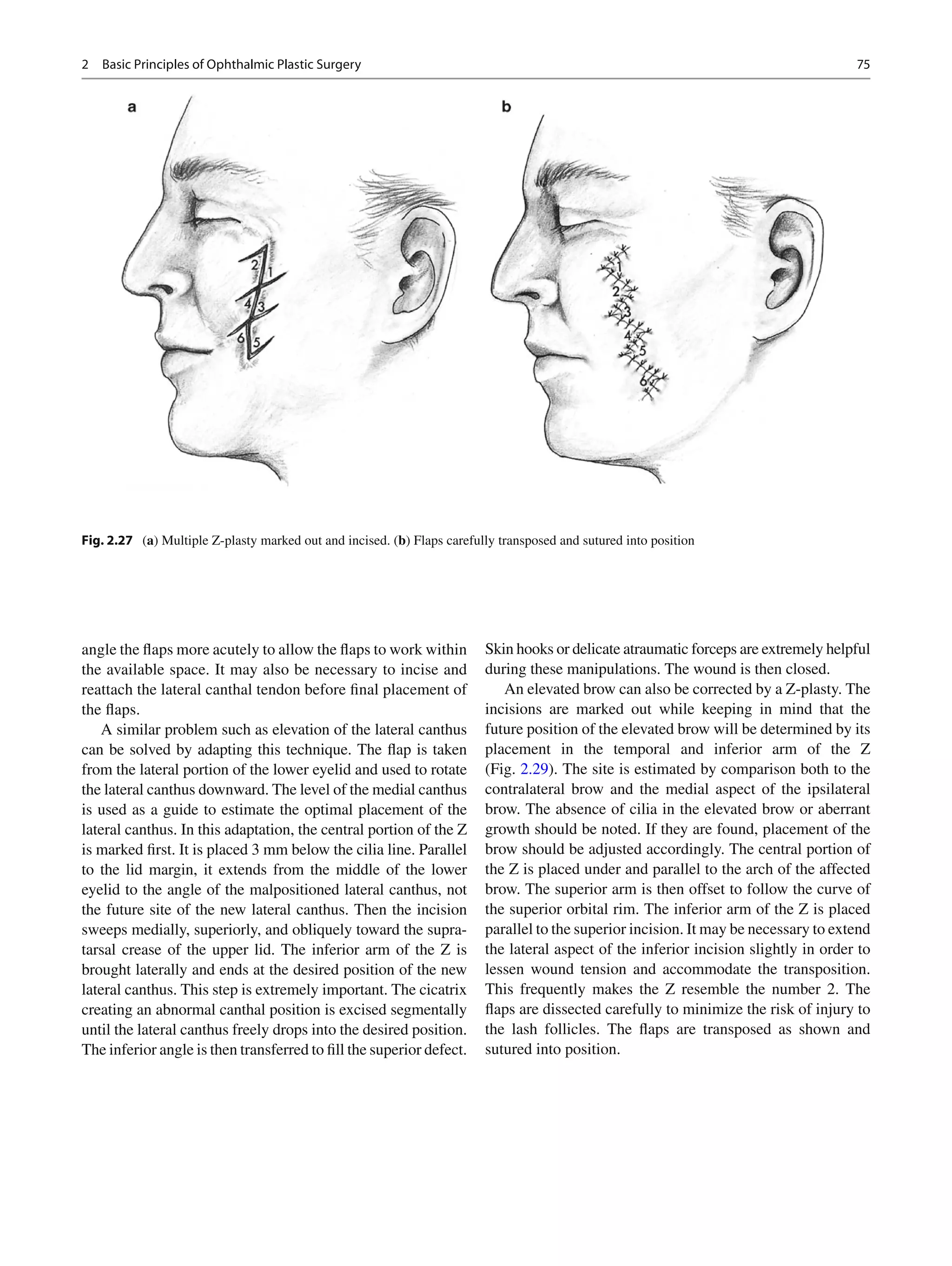 Smith and nesis ophthalmic plastic and reconstructive surgery | PDF