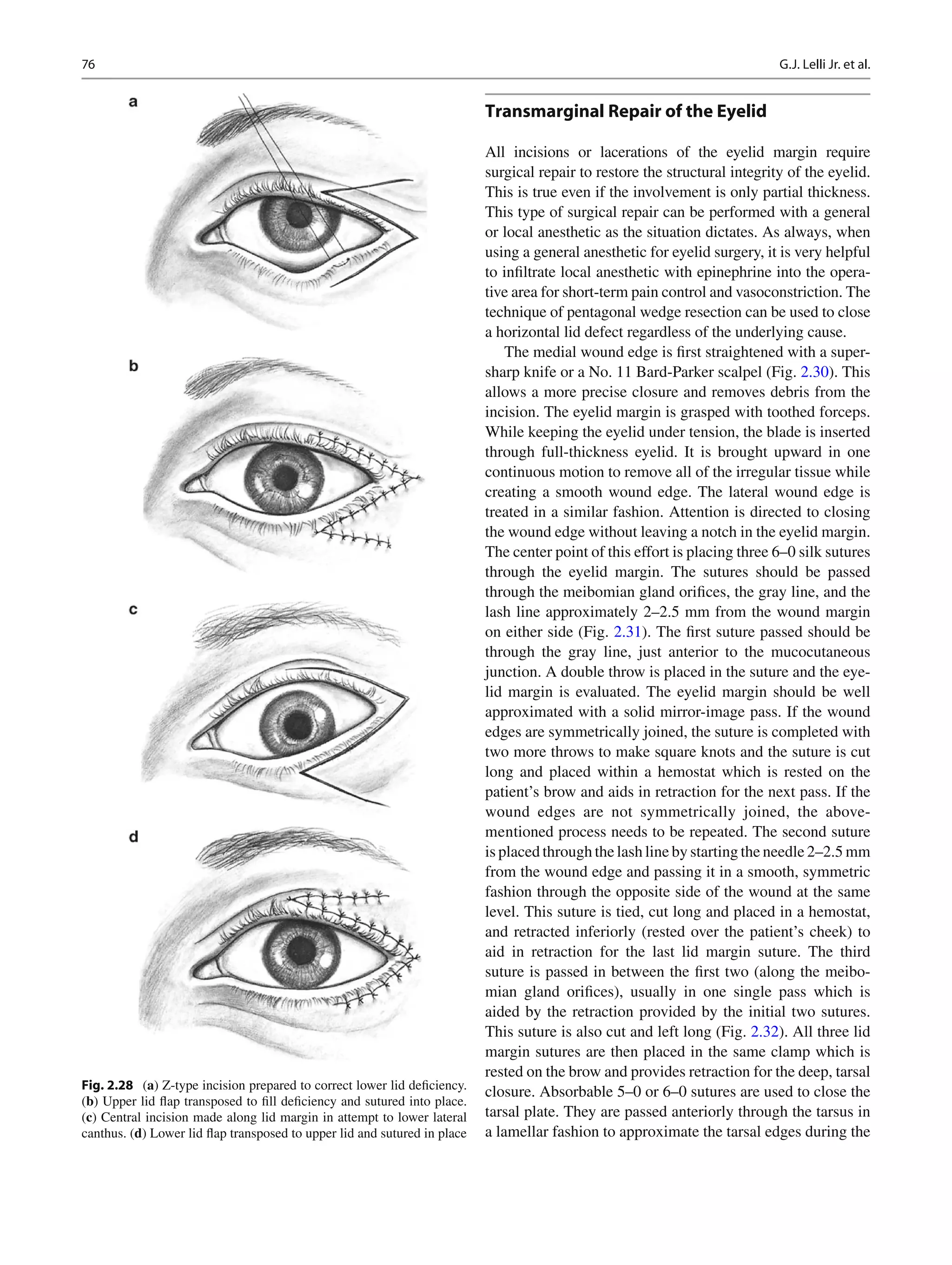Smith and nesis ophthalmic plastic and reconstructive surgery | PDF