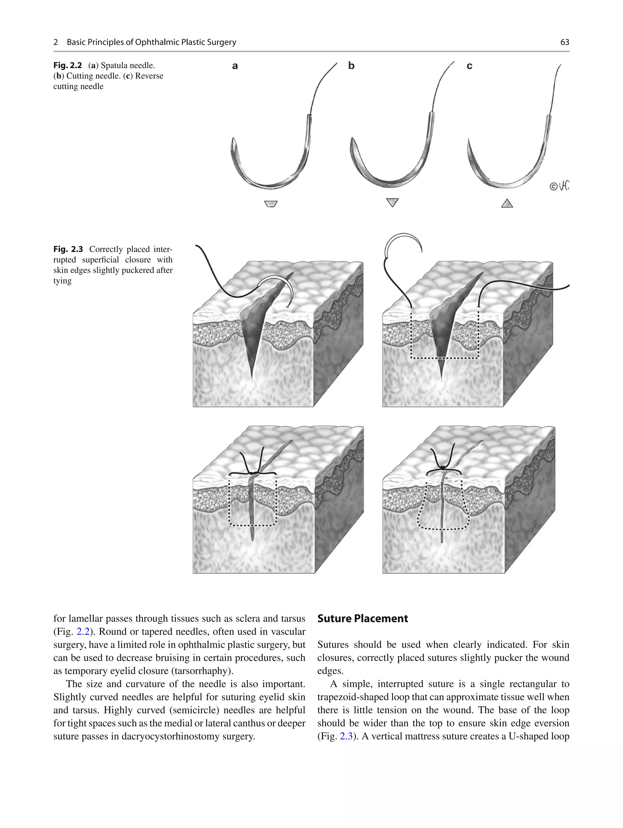 Smith and nesis ophthalmic plastic and reconstructive surgery | PDF